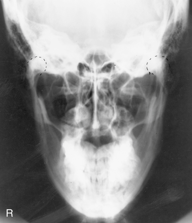 Bontrager's Textbook of Radiographic Positioning and Related Anatomy