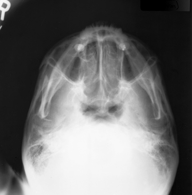 Bontrager's Textbook of Radiographic Positioning and Related Anatomy