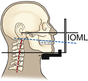 Bontrager's Textbook of Radiographic Positioning and Related Anatomy