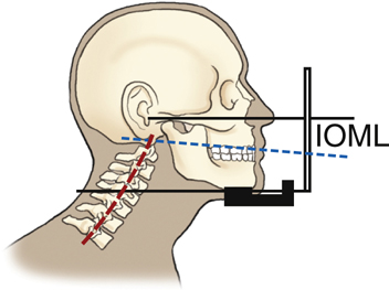 Bontrager's Textbook of Radiographic Positioning and Related Anatomy