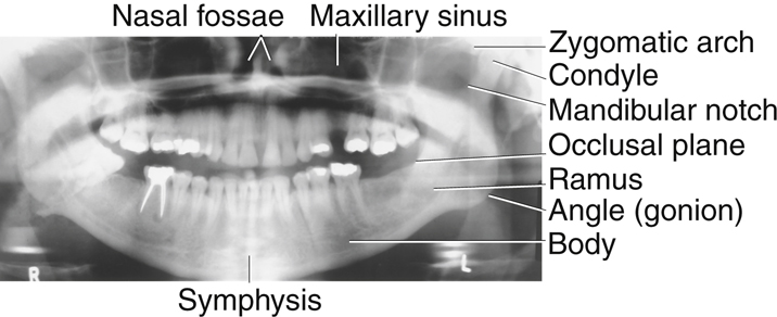 Bontrager's Textbook of Radiographic Positioning and Related Anatomy