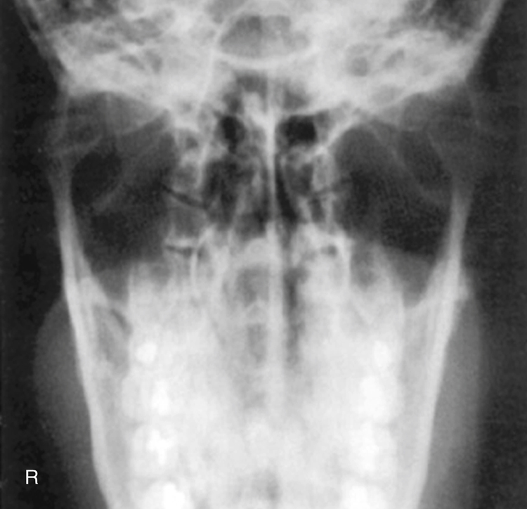 Bontrager's Textbook of Radiographic Positioning and Related Anatomy