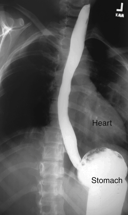 Bontrager's Textbook of Radiographic Positioning and Related Anatomy