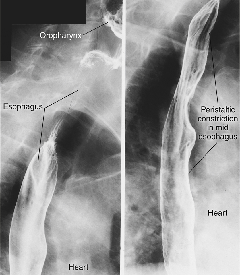 Bontrager's Textbook of Radiographic Positioning and Related Anatomy