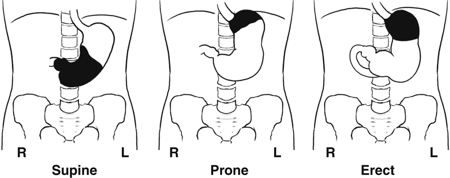 Bontrager's Textbook of Radiographic Positioning and Related Anatomy