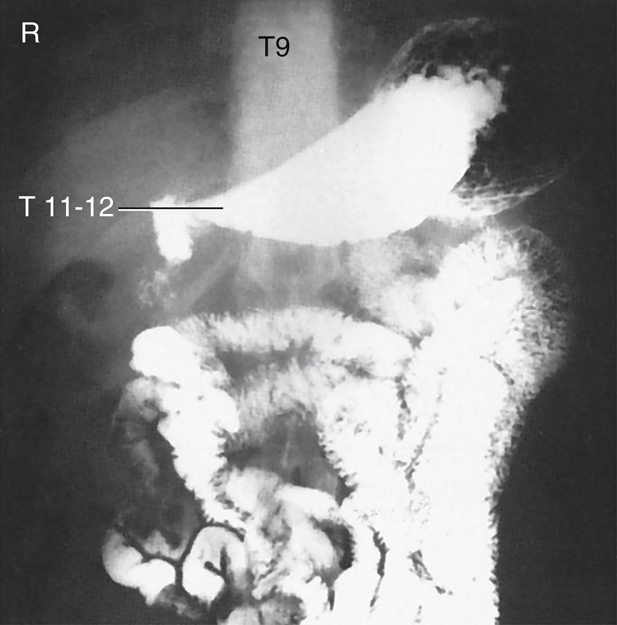 Bontrager's Textbook of Radiographic Positioning and Related Anatomy