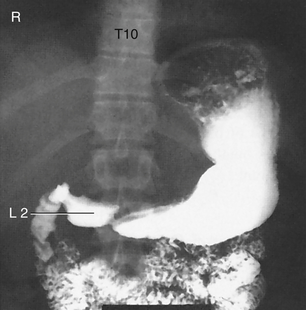 Bontrager's Textbook of Radiographic Positioning and Related Anatomy