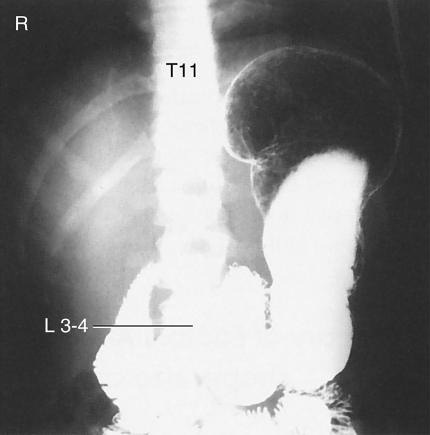 Bontrager's Textbook of Radiographic Positioning and Related Anatomy