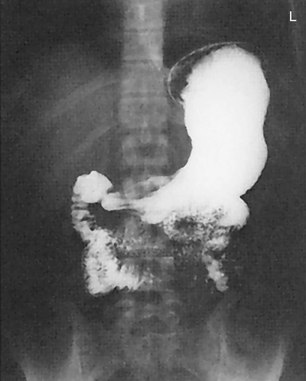 Bontrager's Textbook of Radiographic Positioning and Related Anatomy