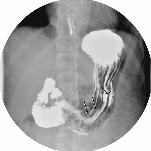 Bontrager's Textbook of Radiographic Positioning and Related Anatomy