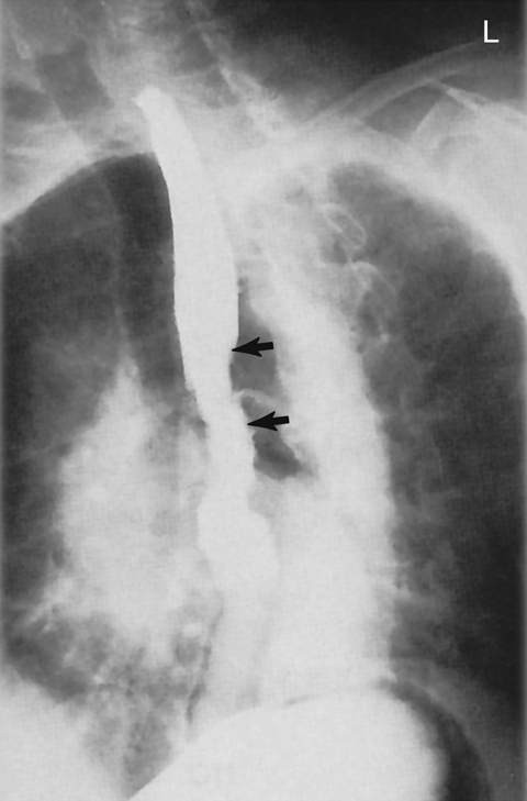 Bontrager's Textbook of Radiographic Positioning and Related Anatomy