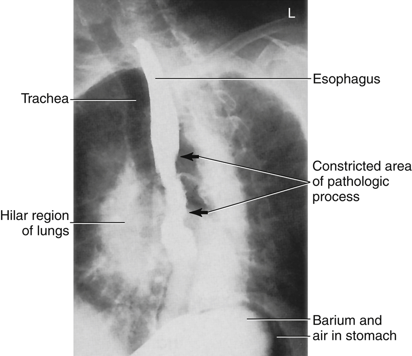 Bontrager's Textbook of Radiographic Positioning and Related Anatomy