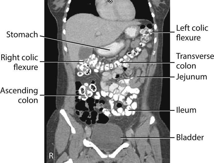 Bontrager's Textbook of Radiographic Positioning and Related Anatomy