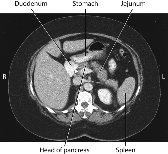 Bontrager's Textbook of Radiographic Positioning and Related Anatomy