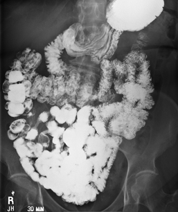 Bontrager's Textbook of Radiographic Positioning and Related Anatomy