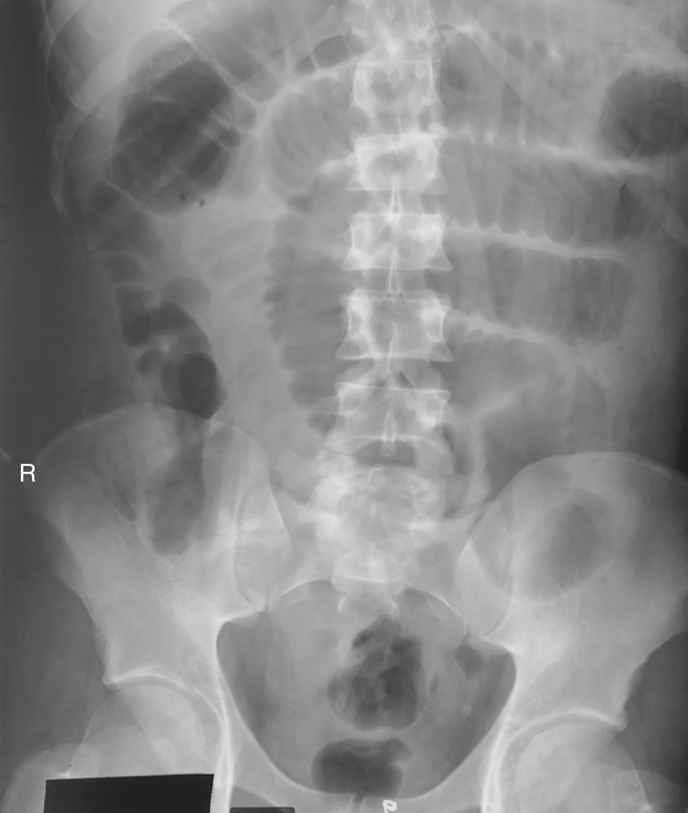 Bontrager's Textbook of Radiographic Positioning and Related Anatomy
