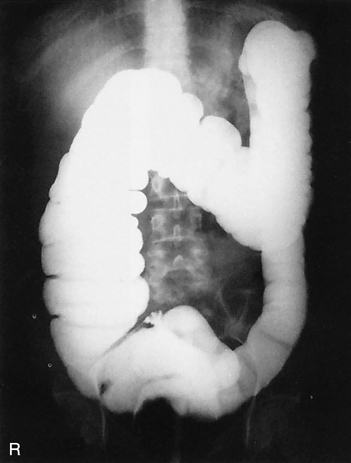 Bontrager's Textbook of Radiographic Positioning and Related Anatomy