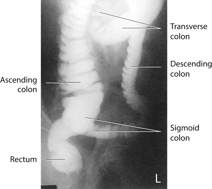 Bontrager's Textbook of Radiographic Positioning and Related Anatomy
