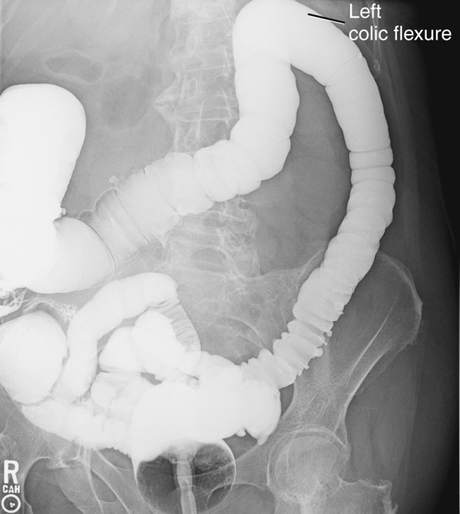 Bontrager's Textbook of Radiographic Positioning and Related Anatomy