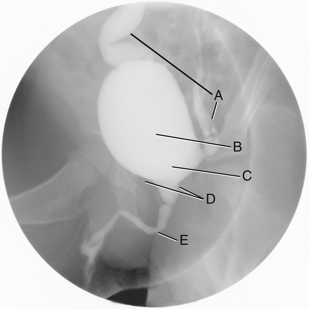 Bontrager's Textbook of Radiographic Positioning and Related Anatomy