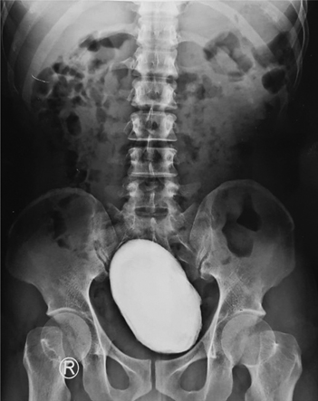 Bontrager's Textbook of Radiographic Positioning and Related Anatomy