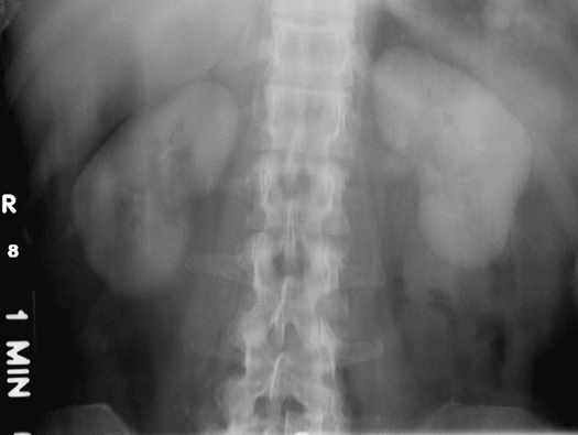 Bontrager's Textbook of Radiographic Positioning and Related Anatomy