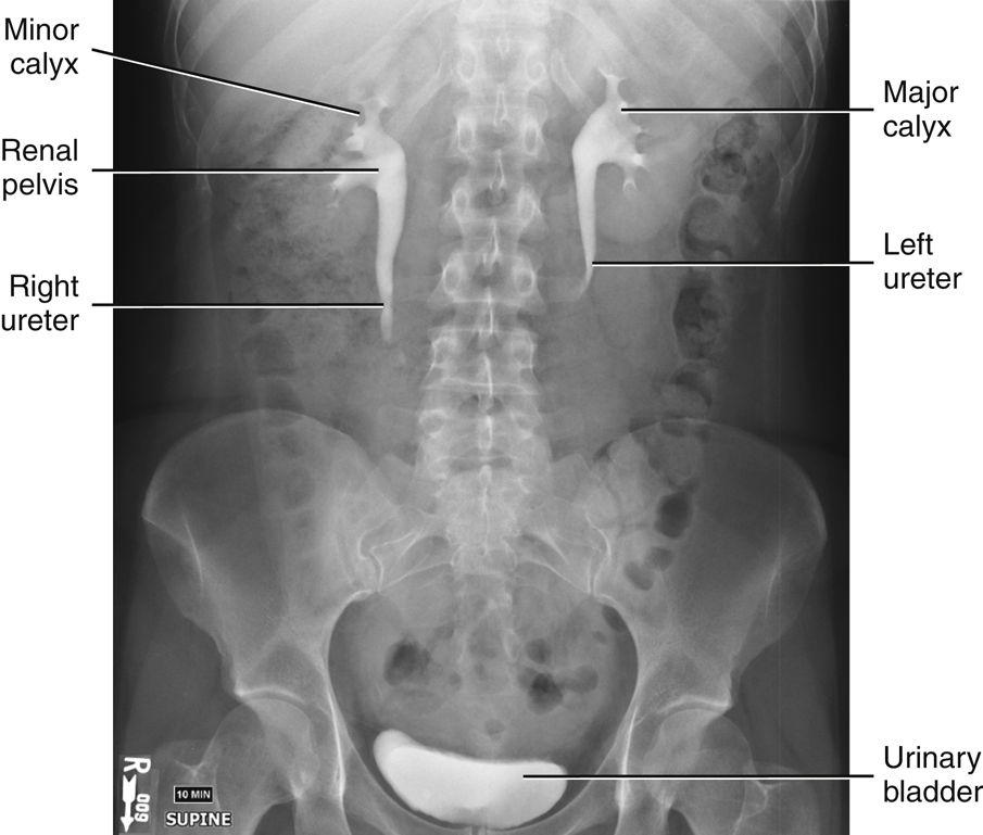 Bontrager's Textbook of Radiographic Positioning and Related Anatomy