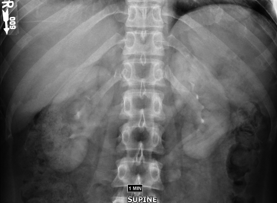 Bontrager's Textbook of Radiographic Positioning and Related Anatomy