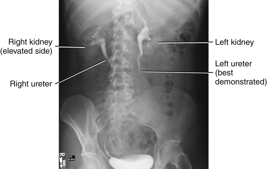 Bontrager's Textbook of Radiographic Positioning and Related Anatomy