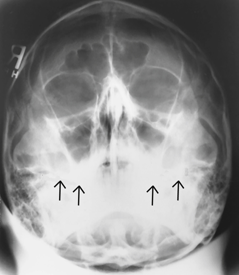 Bontrager's Textbook of Radiographic Positioning and Related Anatomy