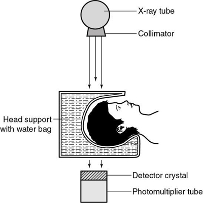 Computed tomography: An overview