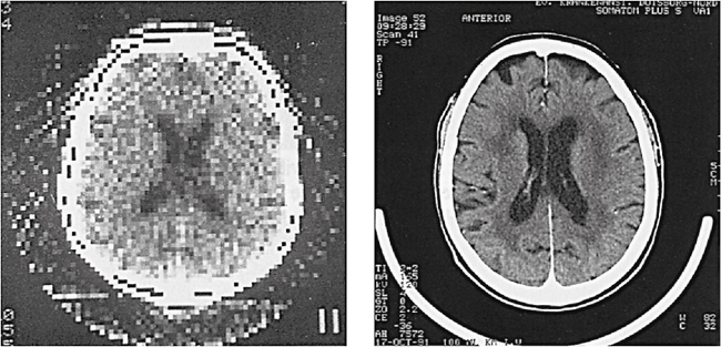 Computed tomography: An overview