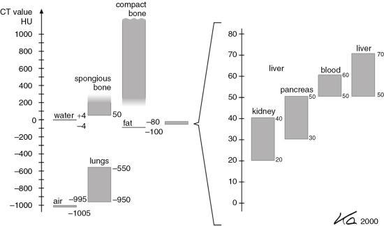 Physical principles of computed tomography