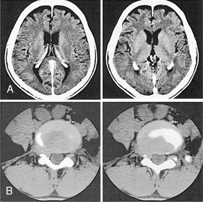 Data acquisition concepts