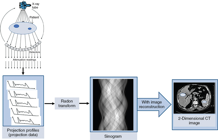 Image reconstruction