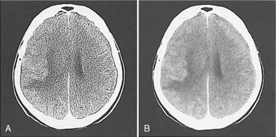 Image reconstruction