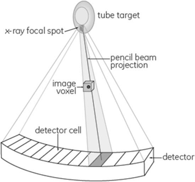 Iterative and deep learning reconstruction basics