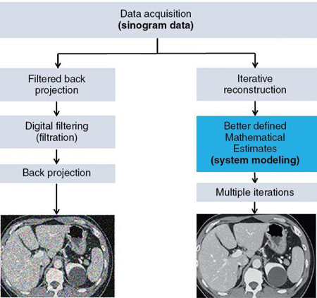 Iterative and deep learning reconstruction basics