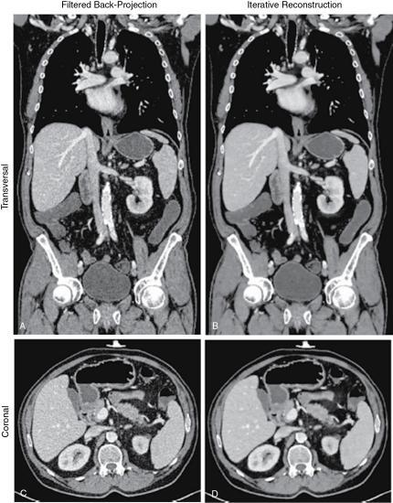 Iterative and deep learning reconstruction basics