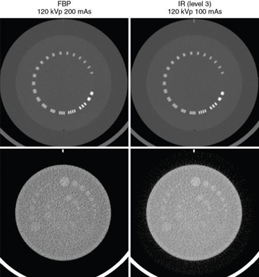 Iterative and deep learning reconstruction basics