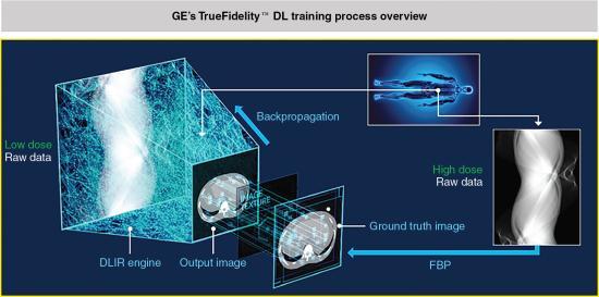 Iterative and deep learning reconstruction basics