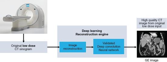 Iterative and deep learning reconstruction basics