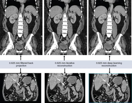 Iterative and deep learning reconstruction basics