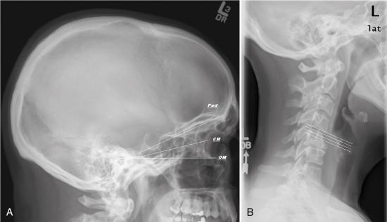 Computed tomography of the head, cerebral vessels, neck, and spine