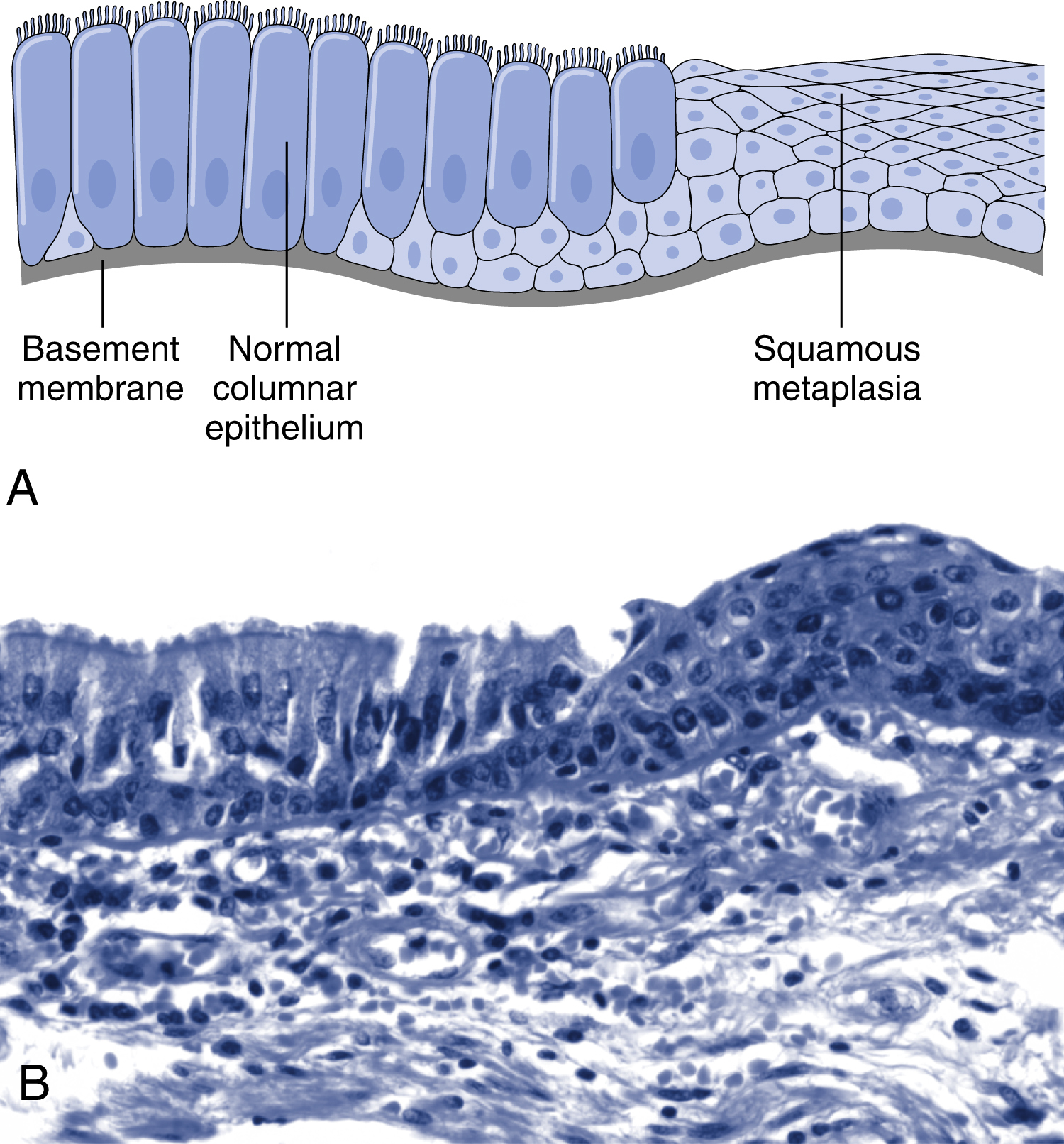 Cell Injury, Cell Death, and Adaptations