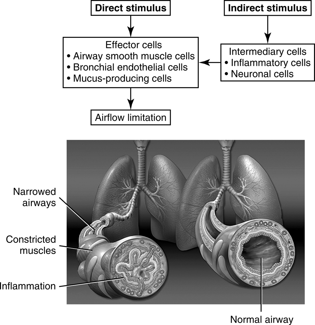 Ruppel's Manual of Pulmonary Function Testing