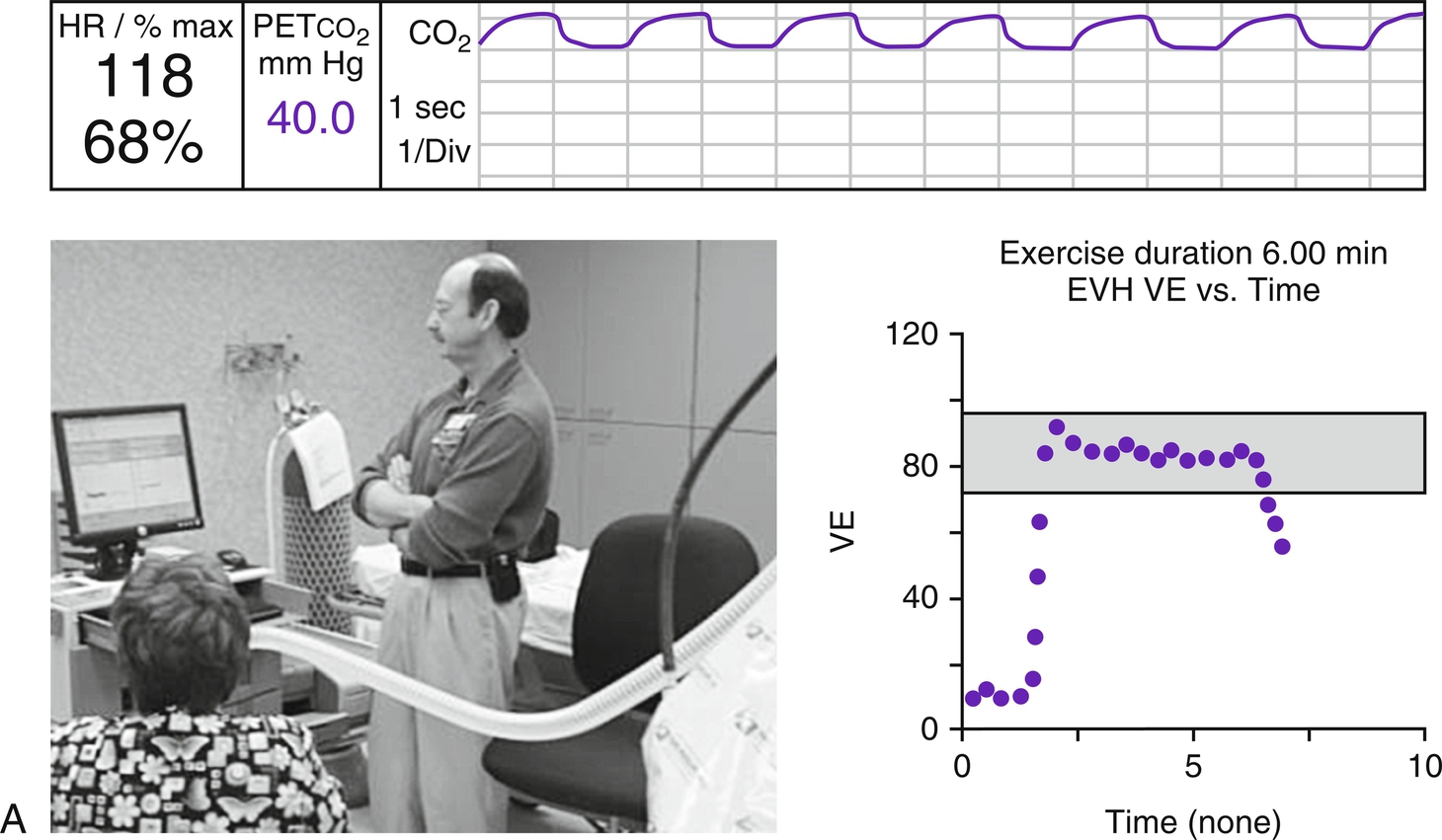 Ruppel's Manual of Pulmonary Function Testing