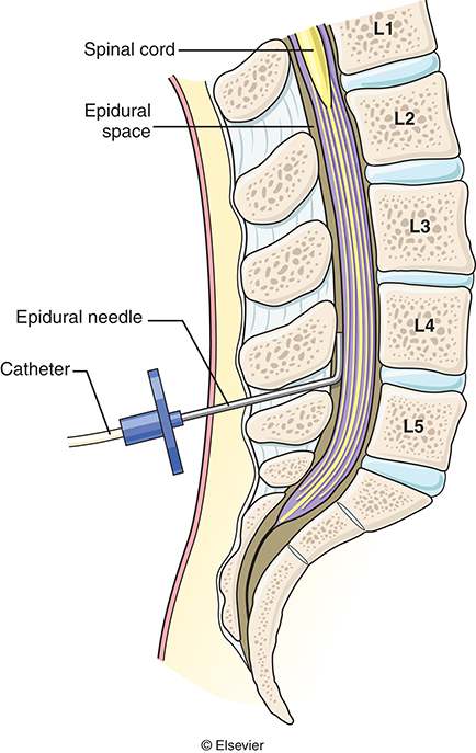 Pain Management, Comfort, Rest, and Sleep