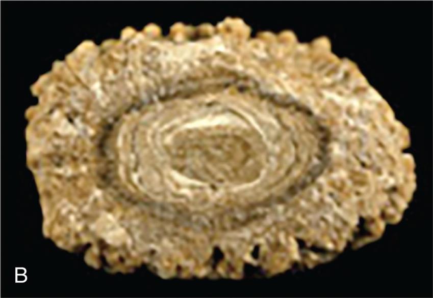 38: Alterations of Renal and Urinary Tract Function