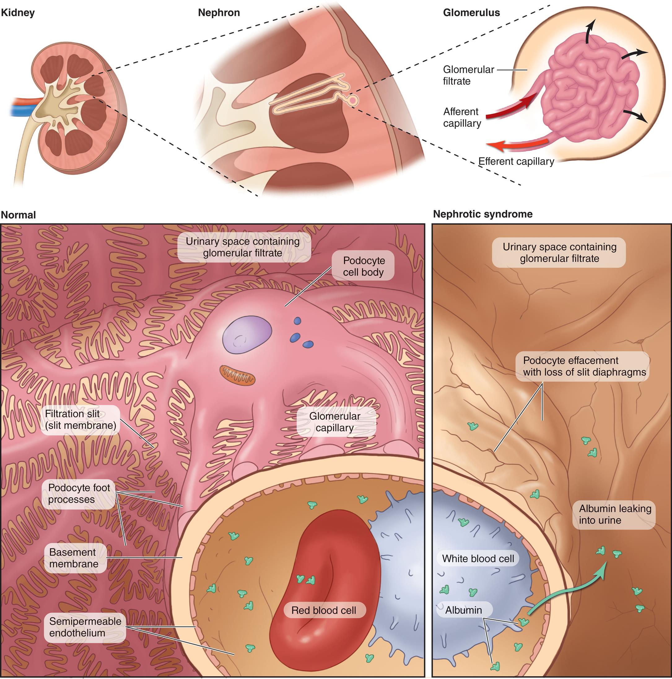 39: Alterations of Renal and Urinary Tract Function in Children